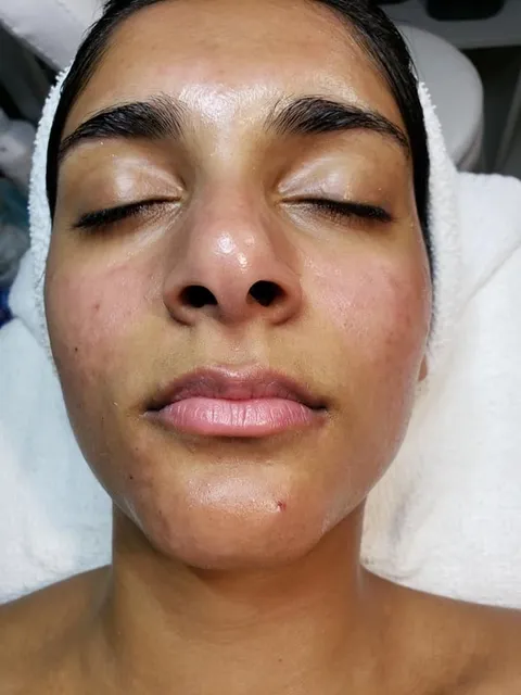 Deep Pore Cleansing - Facial Creations Spa of Tampa Bay LLC