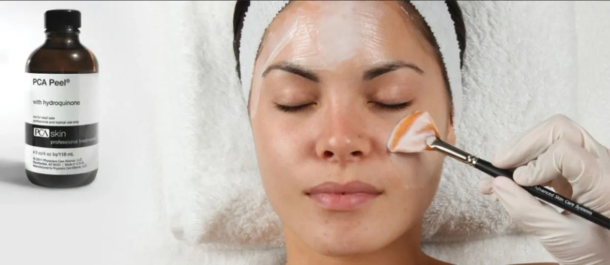 Glycolic Acid 30-70% Chemical Peel - Facial Creations Spa of Tampa Bay LLC